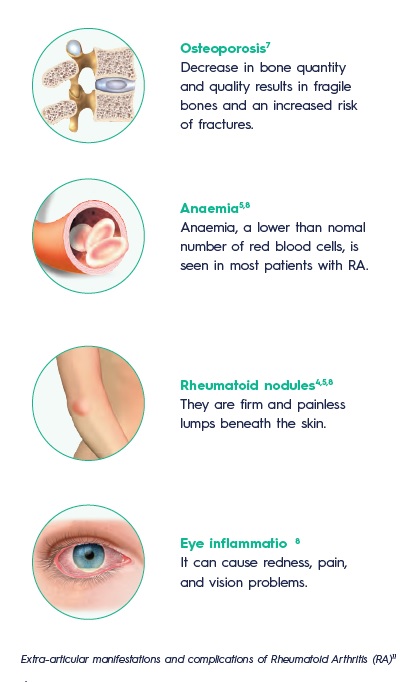 Rheumatoid Arthritis - Articles | Dis-Chem