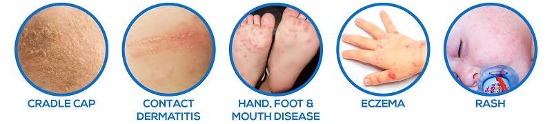 Baby skin health - Articles | Dis-Chem